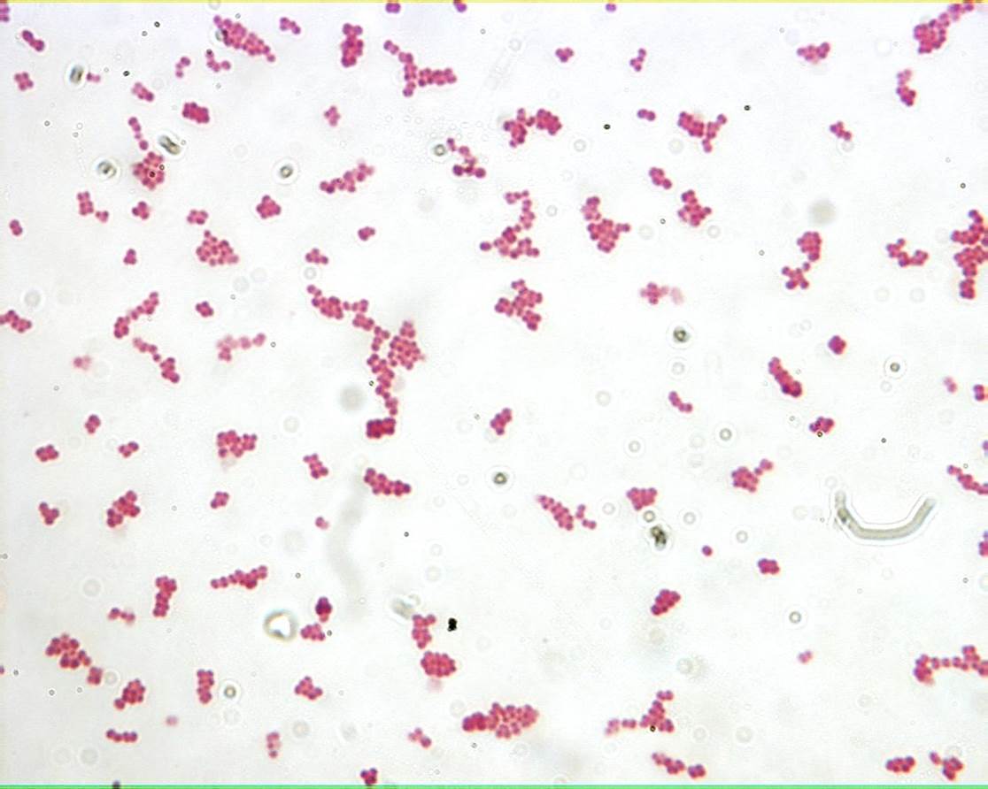 Coccus Bacteria 400x