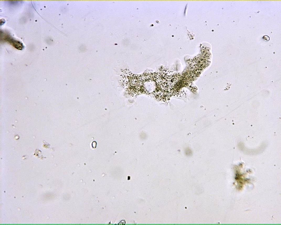 Microscope World Blog Amoeba Under Microscope - vrogue.co Microscope World Blog Amoeba Under Microscope - vrogue.co